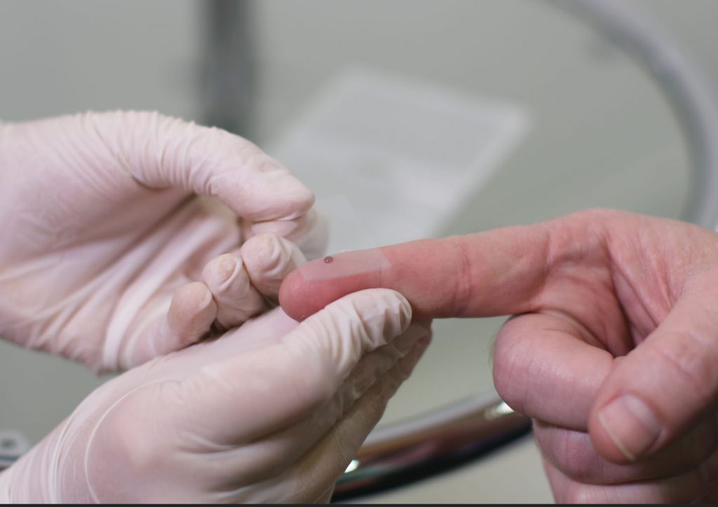 Blood Test Kit – Dr. Hilu